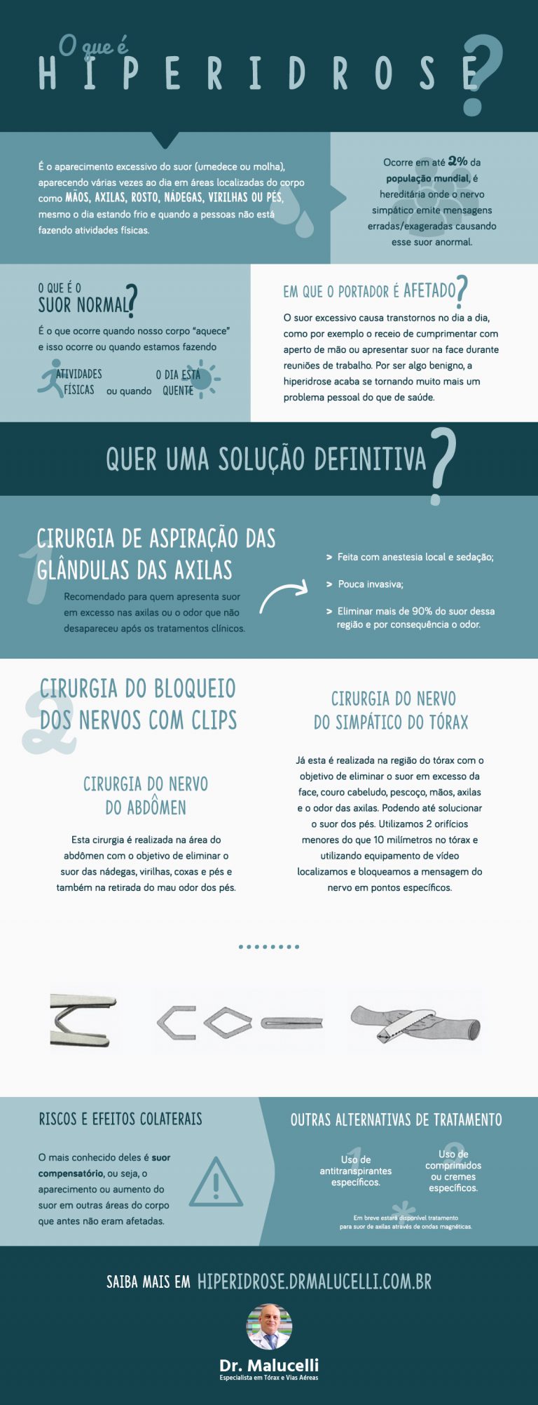 Infográfico: O que é hiperidrose? - Hiperidrose - Dr. Malucelli